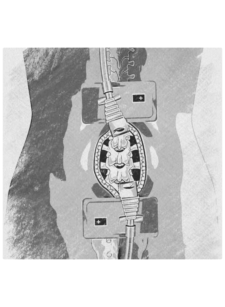 SmokeStop™ – Operating Room Innovations